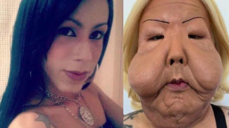 FOTOS: Confira antes e depois de Juju do Pix após primeira cirurgia no ...