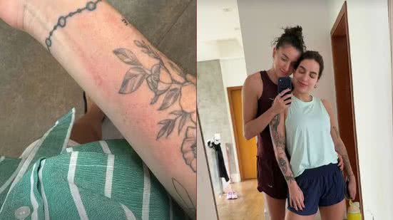 Influenciadora famosa exibe hematomas após ‘brincadeira’ com namorada; veja