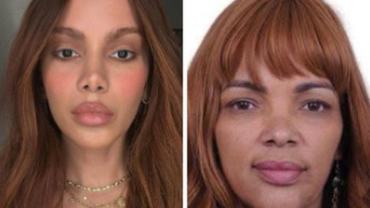 Anitta vira meme após plástica e é comparada a Flordelis: "Não consigo ...