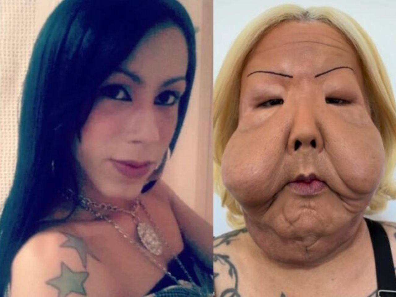 FOTOS: Confira antes e depois de Juju do Pix após primeira cirurgia no ...