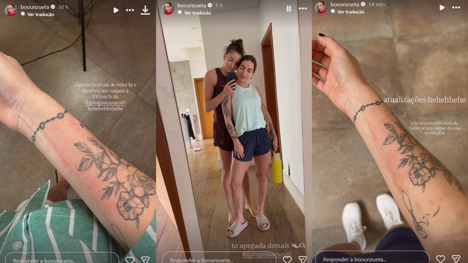 Influenciadora famosa exibe hematomas após ‘brincadeira’ com namorada; veja