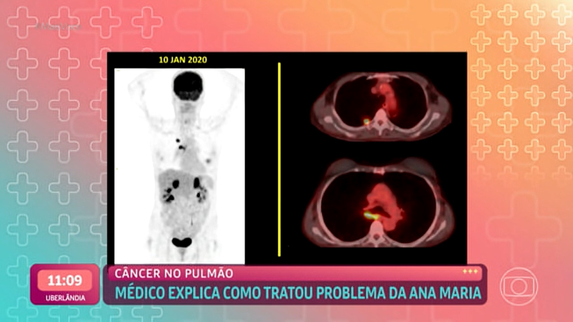 Ana Maria Braga faz revelação chocante sobre câncer e divulga foto ...