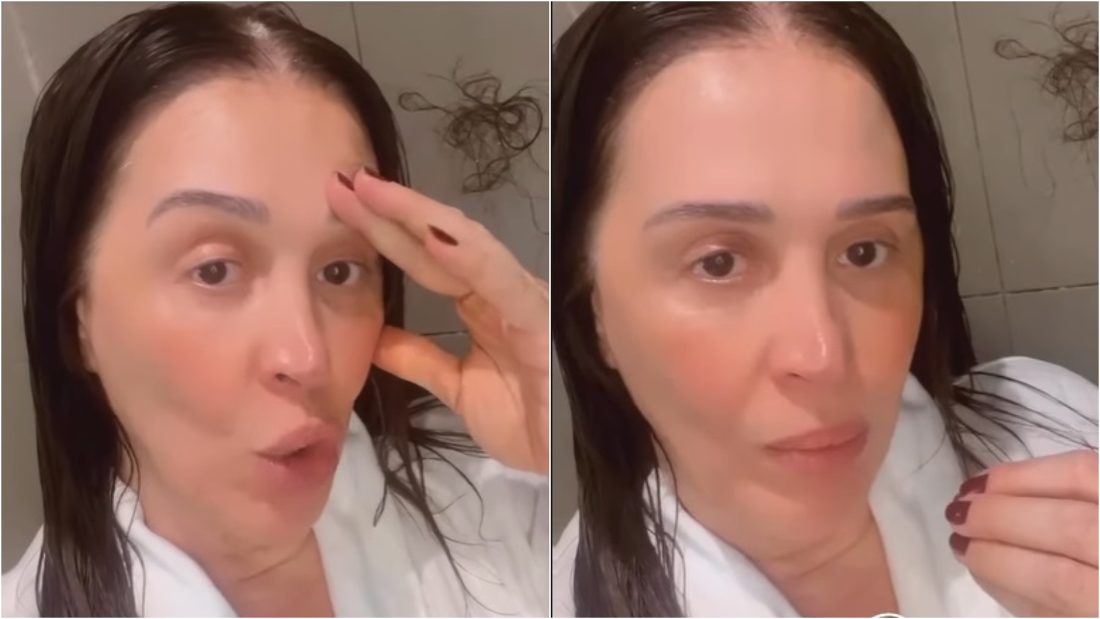 Claudia Raia revela problema dermatológico após gravidez: “Surreal"
