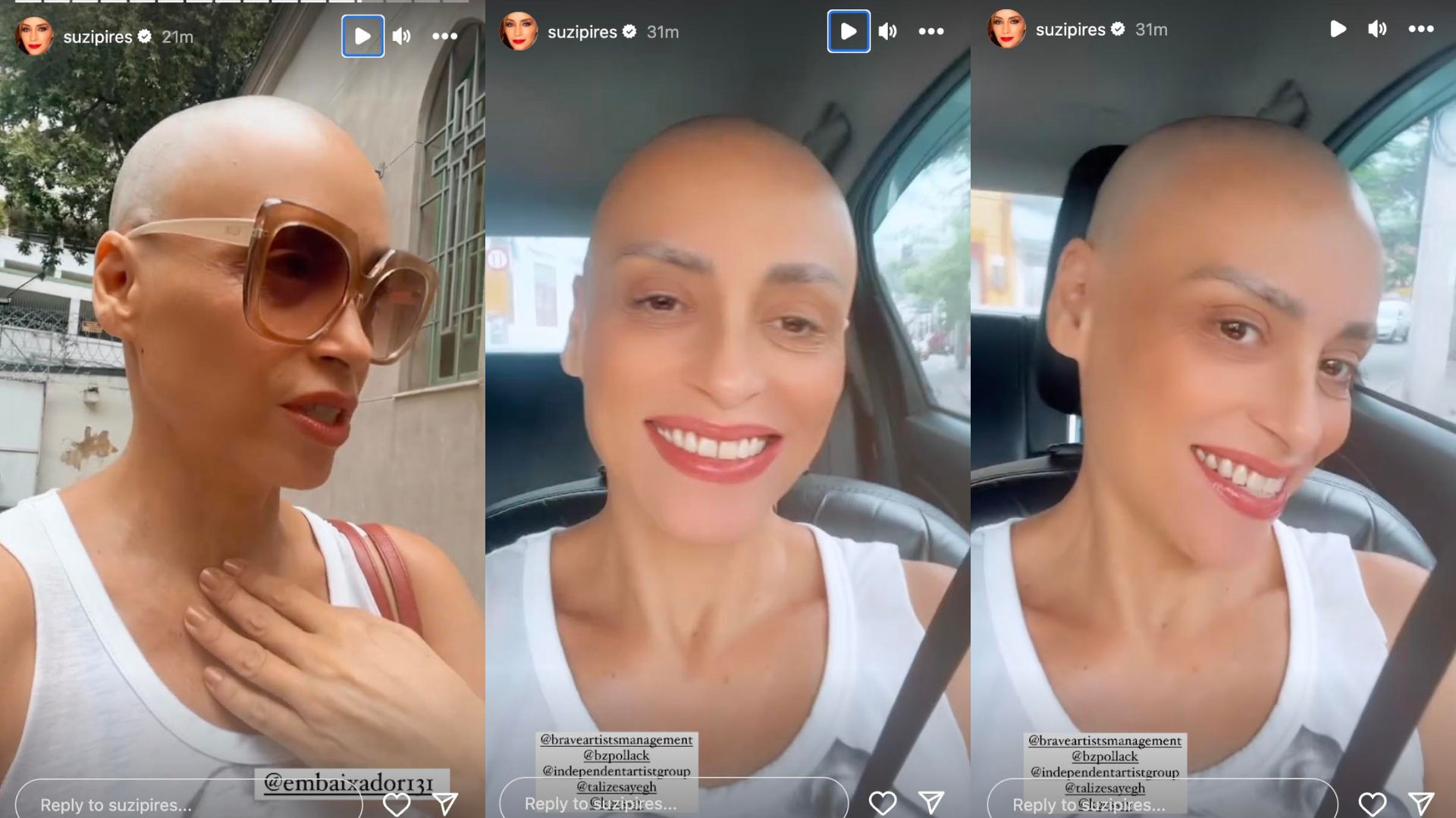 Ex-atriz da Globo passa por mudança radical e fica completamente careca ...