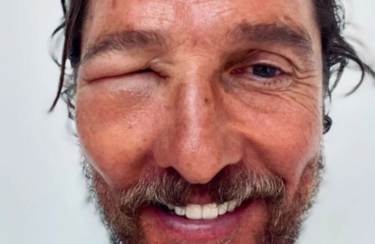 Astro de Hollywood surge irreconhecível e preocupa fãs ao aparecer com ...