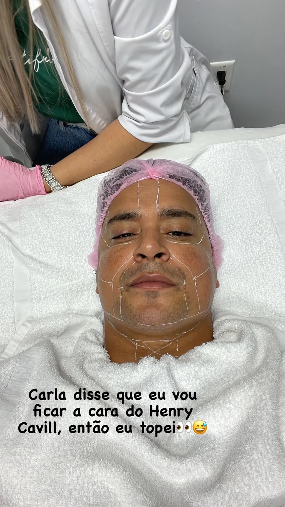 Xanddy faz procedimento no rosto e se compara com ator gringo; confira