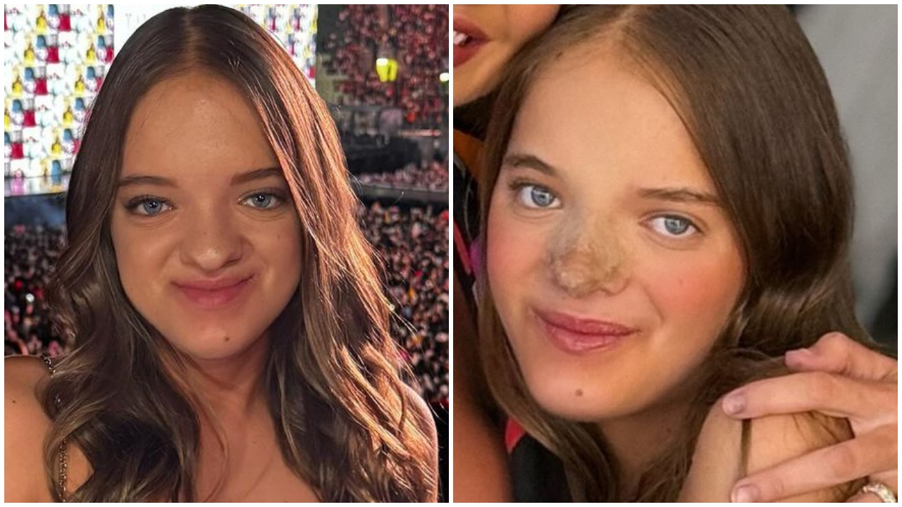 Filha de Roberto Justus conta a verdade sobre cirurgias plásticas