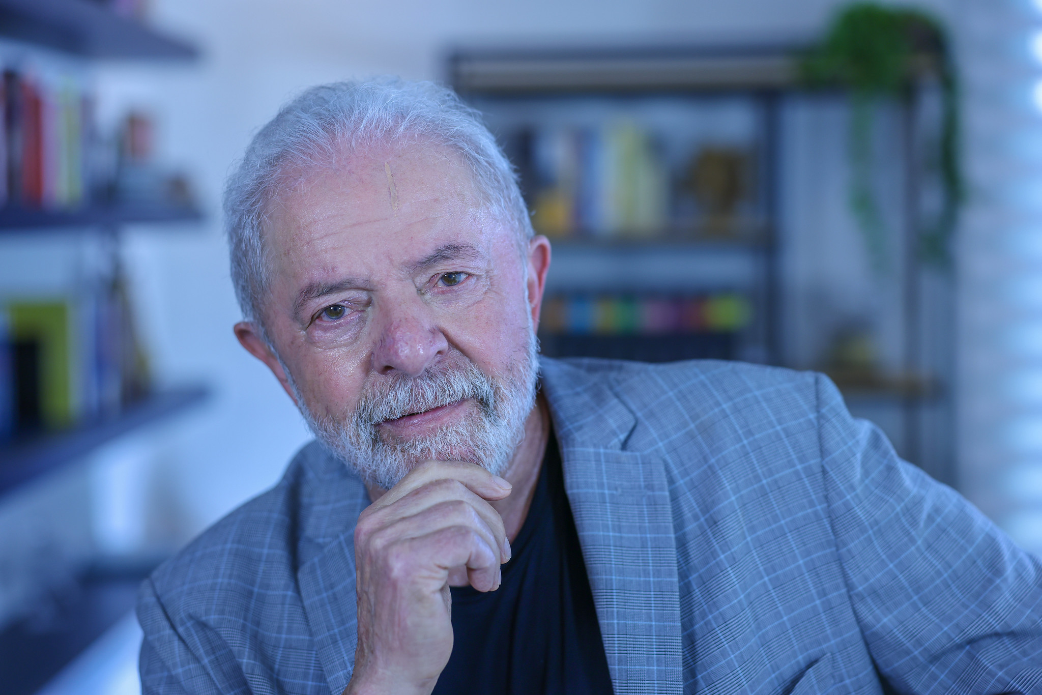 Lula foi internado no hospital Sírio-Libanês para retirada de lesão